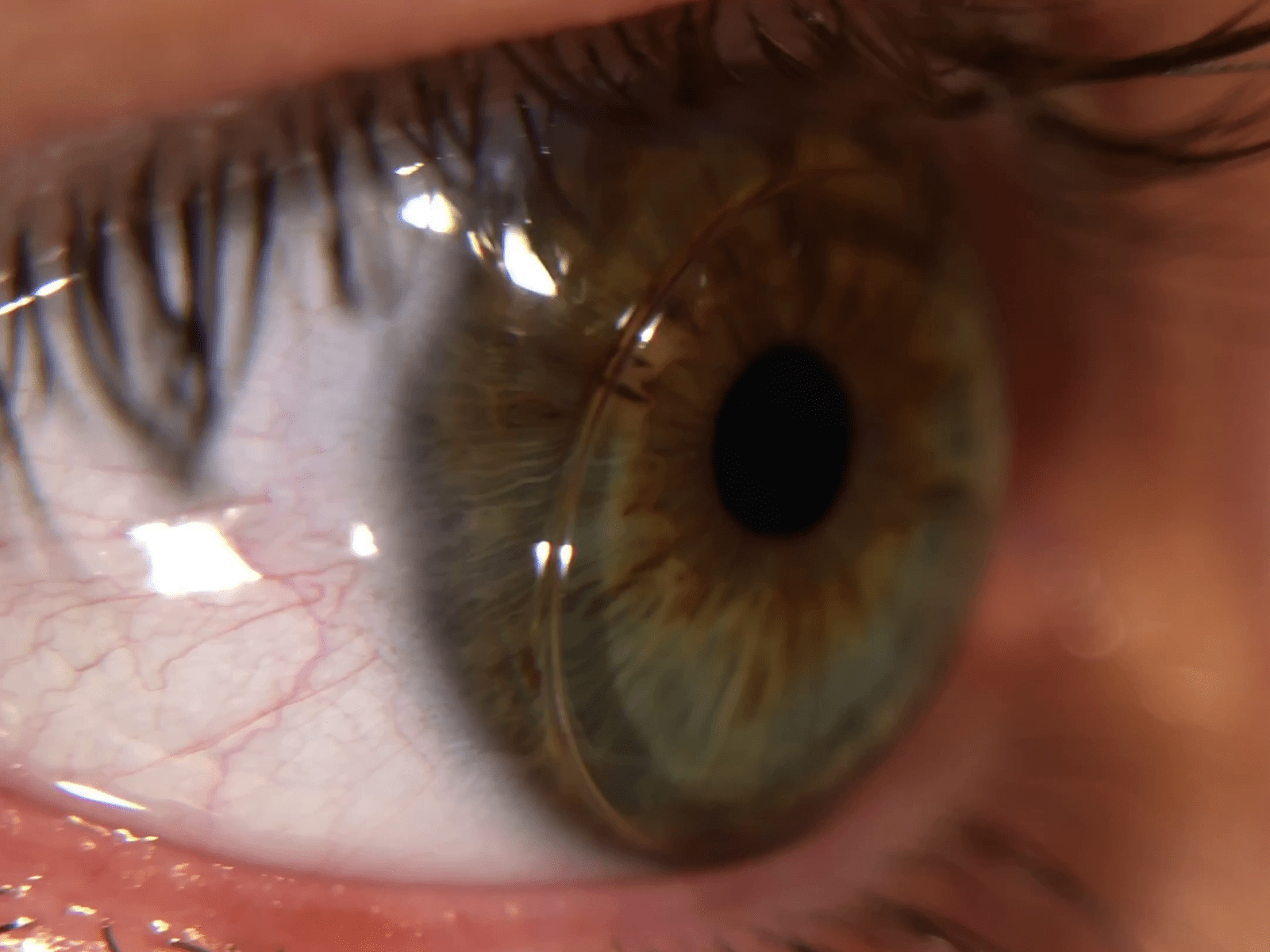 Quelles sont les différents types de lentilles